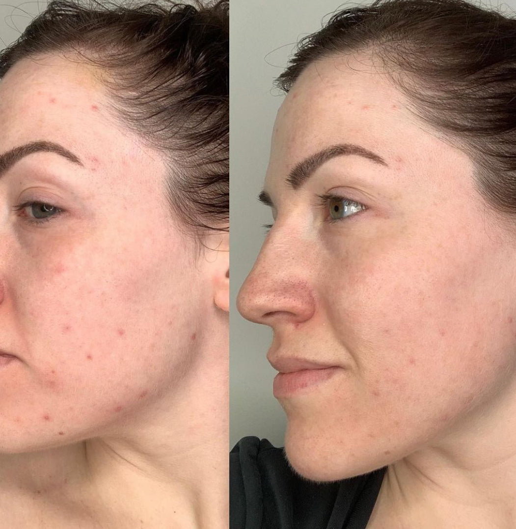 Sleek Skin Serum 30ml – CANDYCUSH